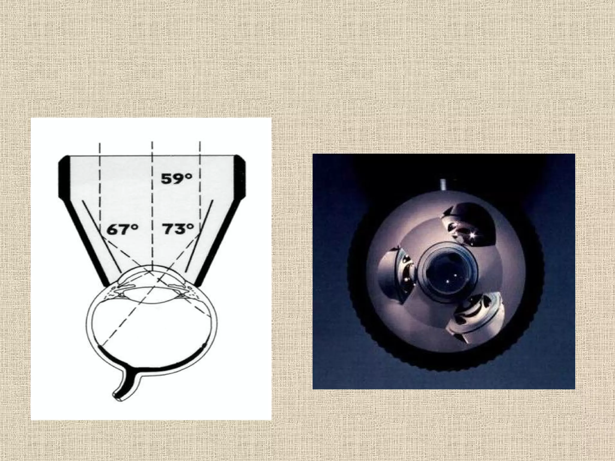 Fundus examination | PPT
