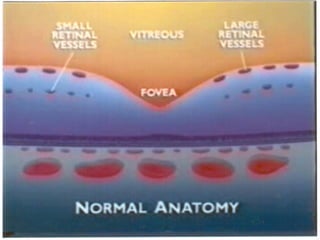 Fundus examination | PPT