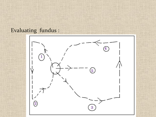 Fundus examination | PPT | Eye and Vision Conditions | Diseases and ...