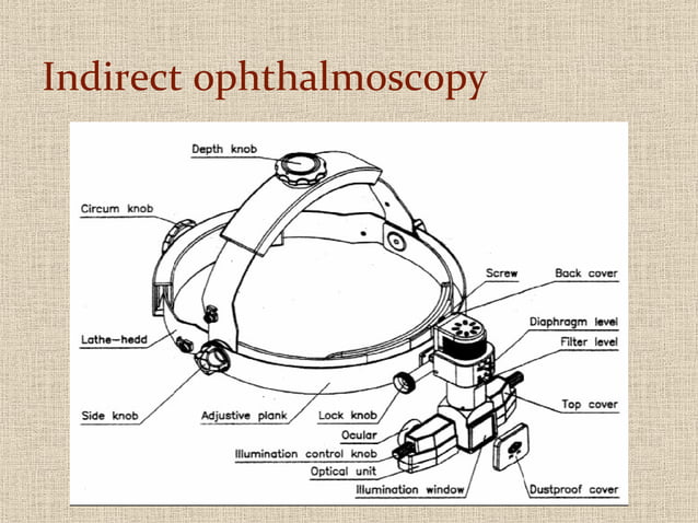 Fundus examination | PPT | Eye and Vision Conditions | Diseases and ...