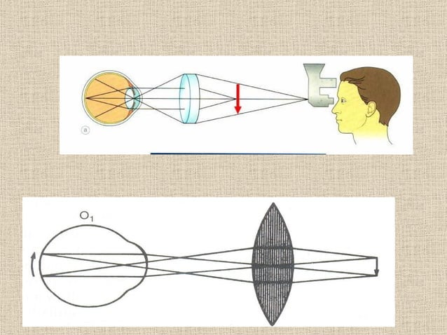 Fundus examination | PPT | Eye and Vision Conditions | Diseases and ...