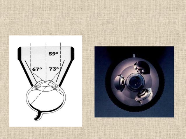 Fundus examination | PPT | Eye and Vision Conditions | Diseases and ...
