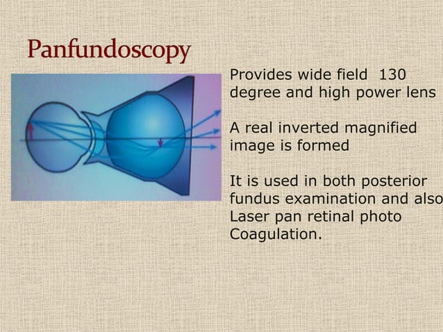 Fundus examination | PPT | Eye and Vision Conditions | Diseases and ...