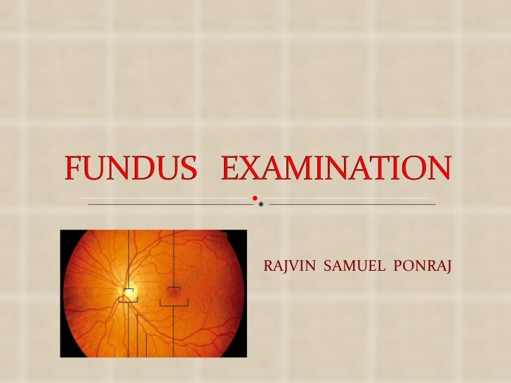 Fundus examination