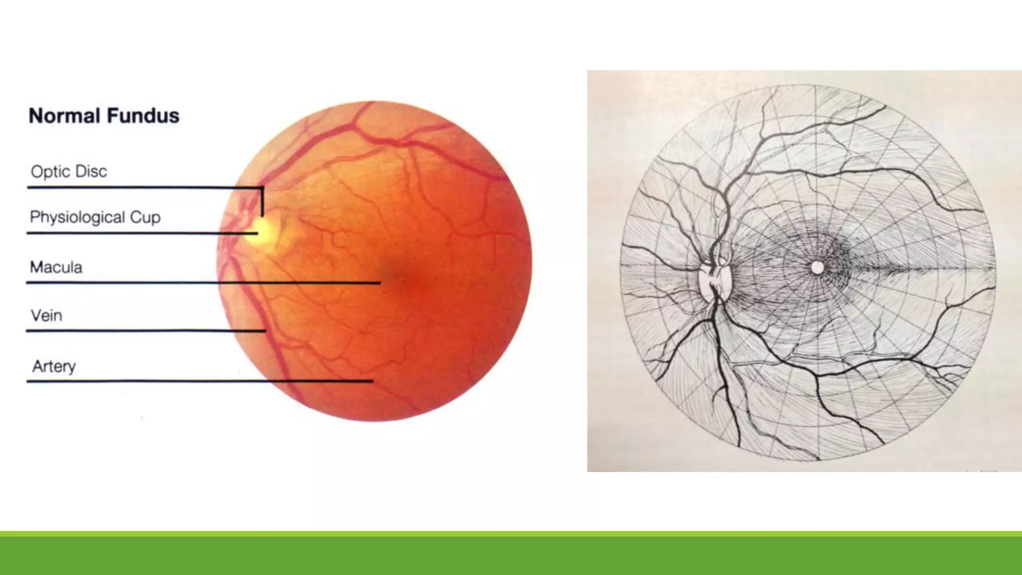 Fundus examination | PPTX