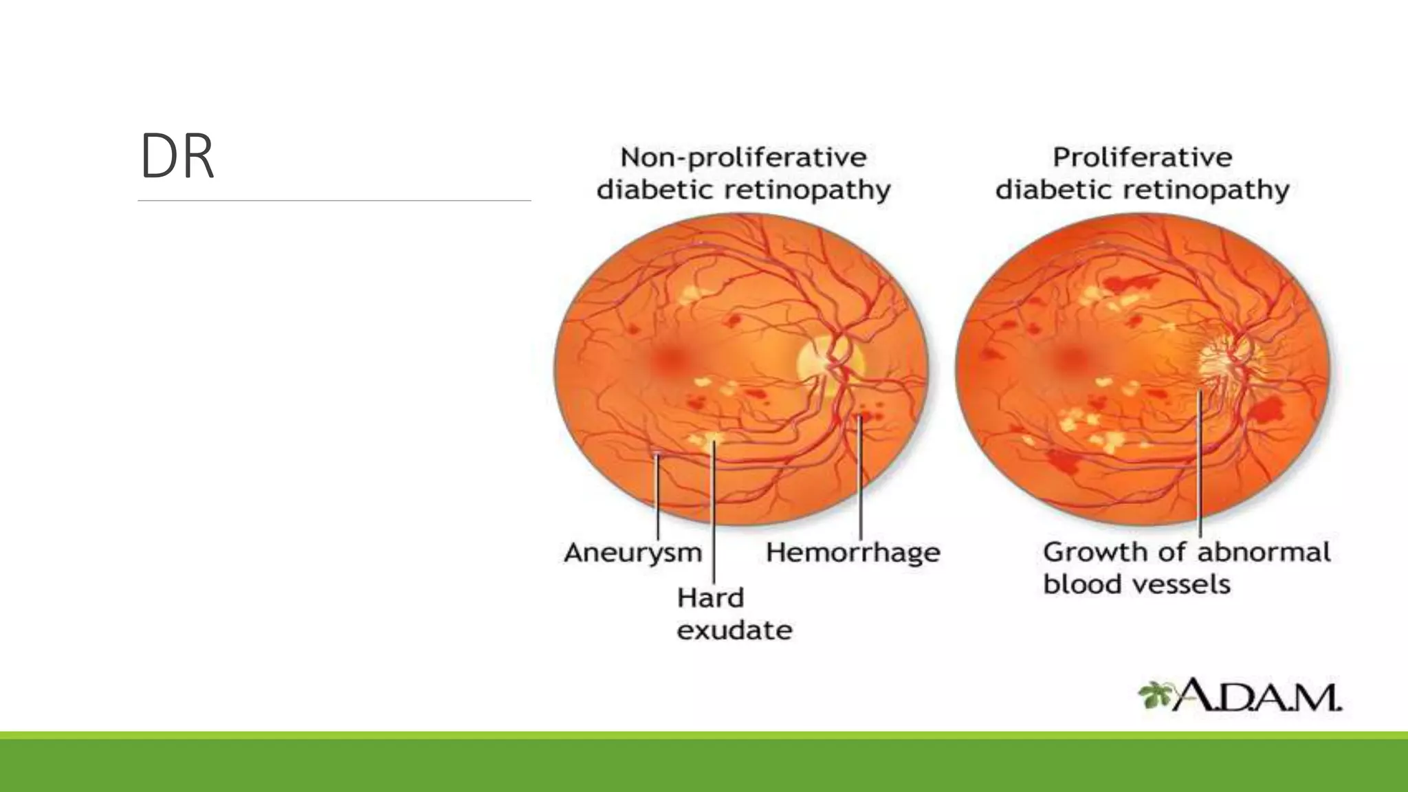 Fundus examination | PPTX