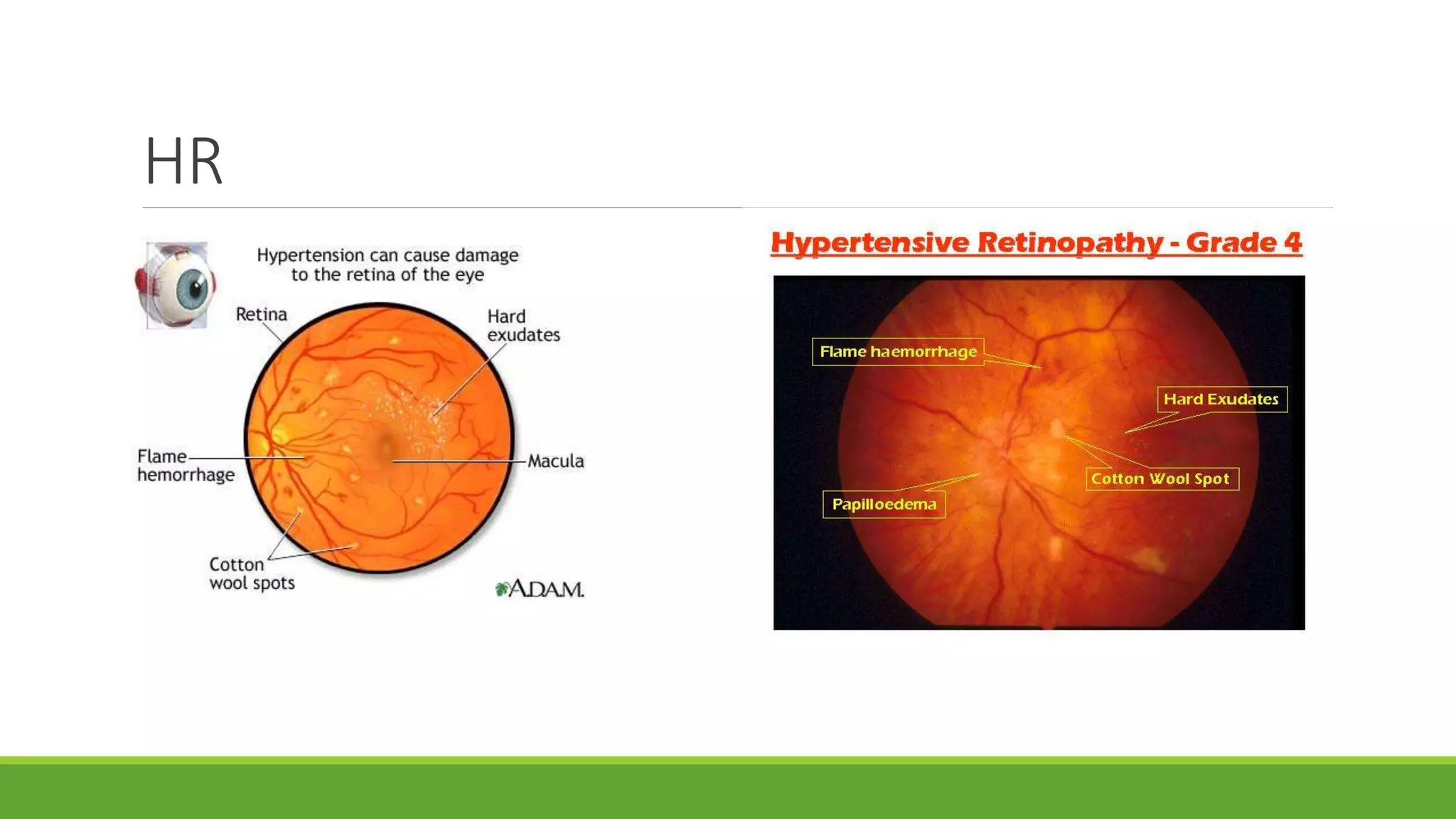 Fundus examination | PPTX