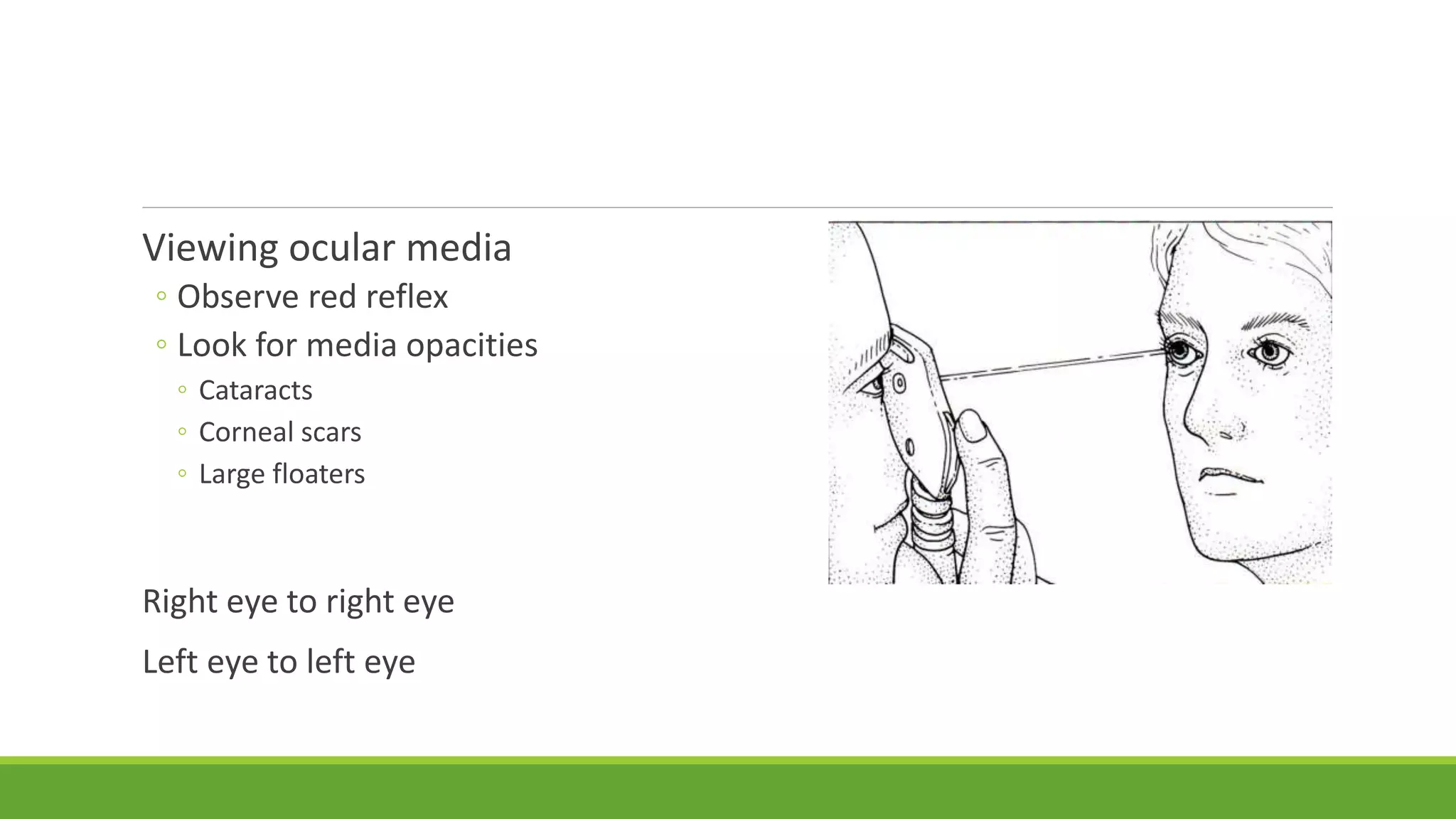 Fundus examination | PPTX