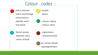 Fundus examination | PPTX