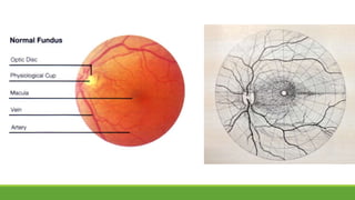 Fundus examination | PPTX