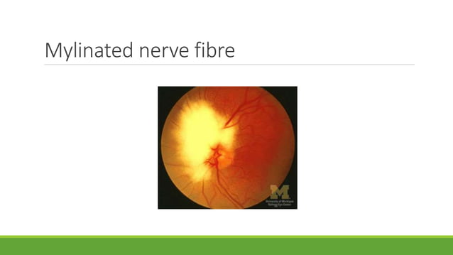 Fundus examination | PPTX | Eye and Vision Conditions | Diseases and ...