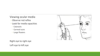 Fundus examination | PPTX