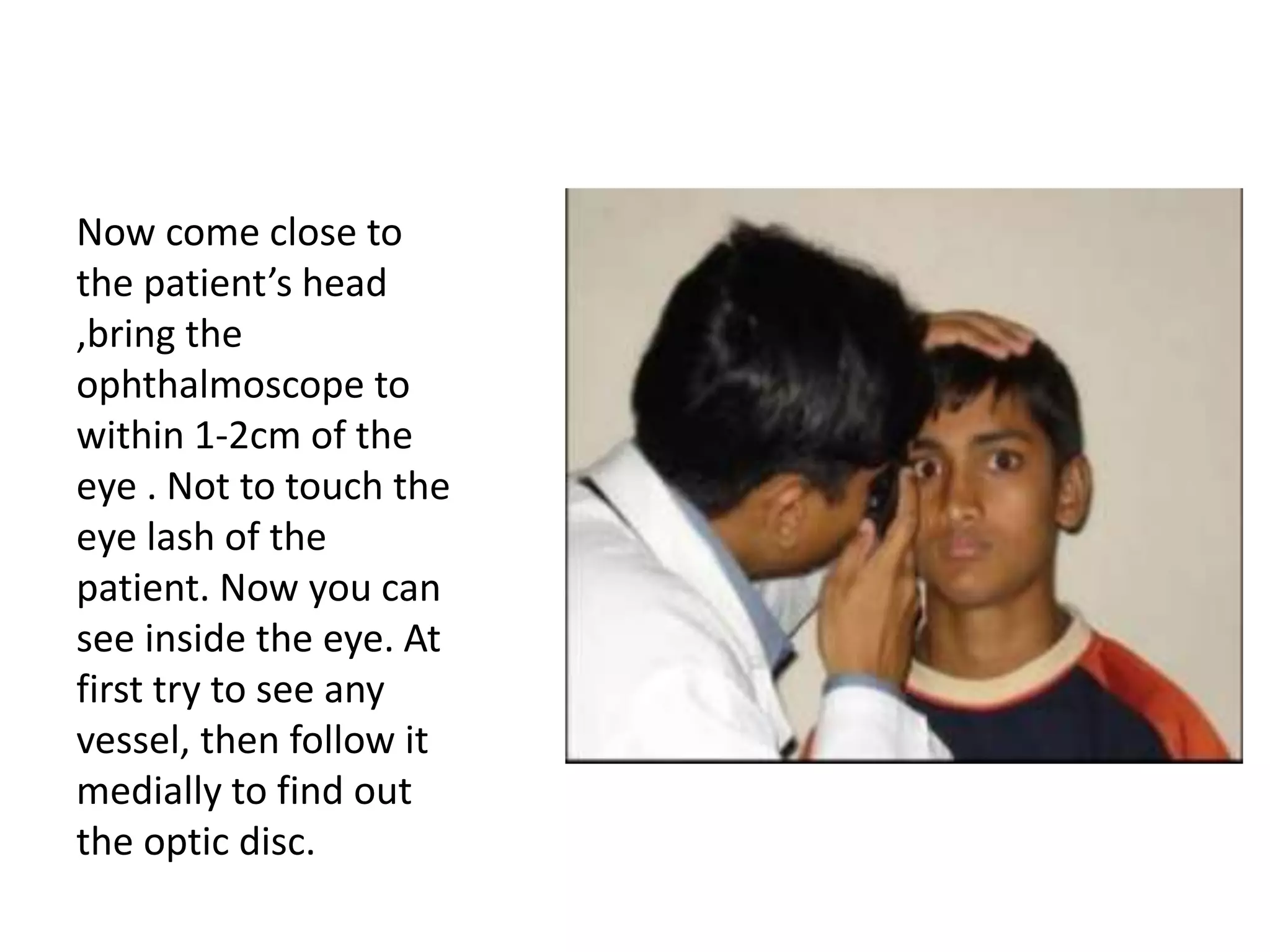 Fundus examination | PPTX