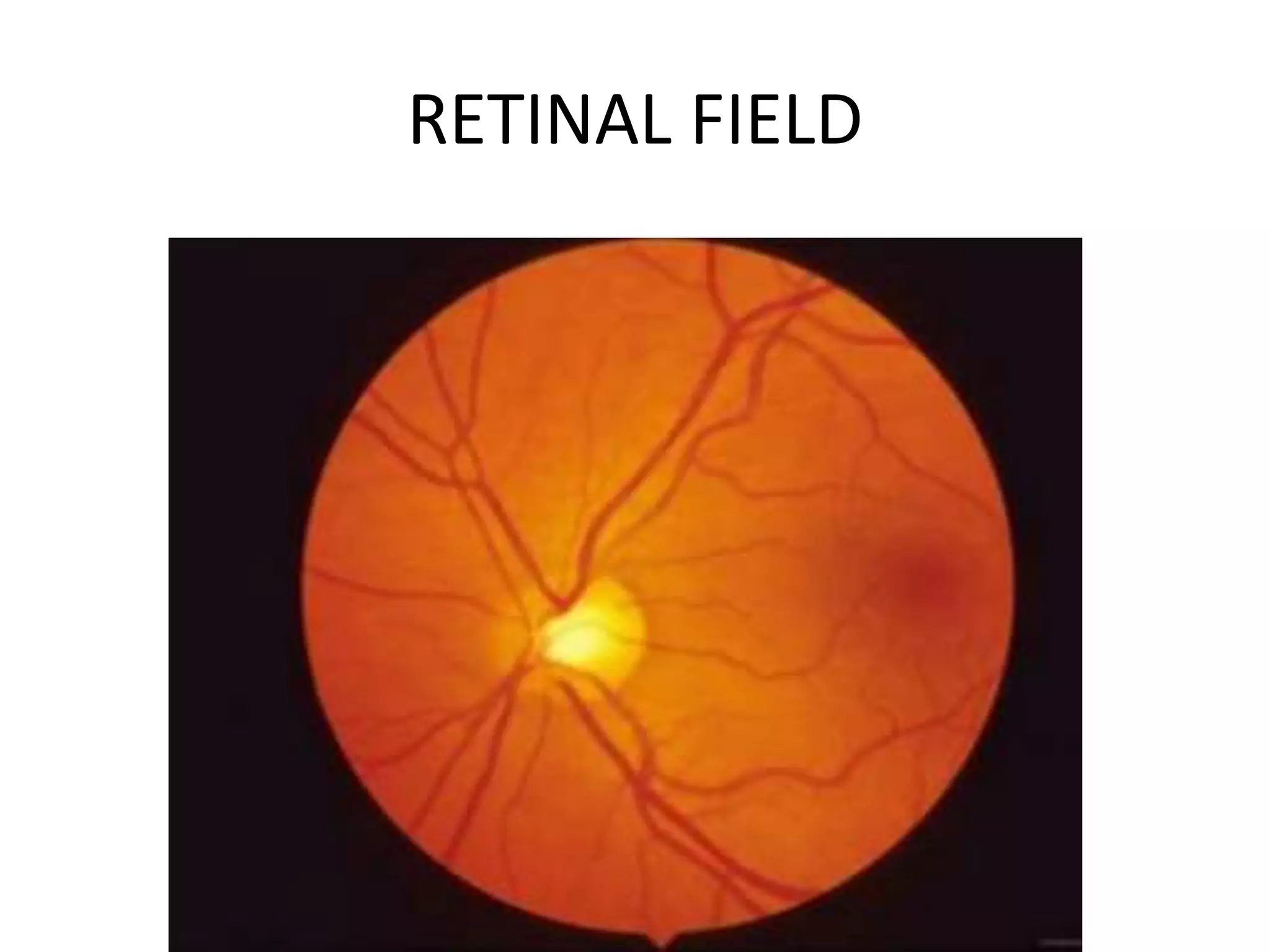 Fundus examination | PPTX