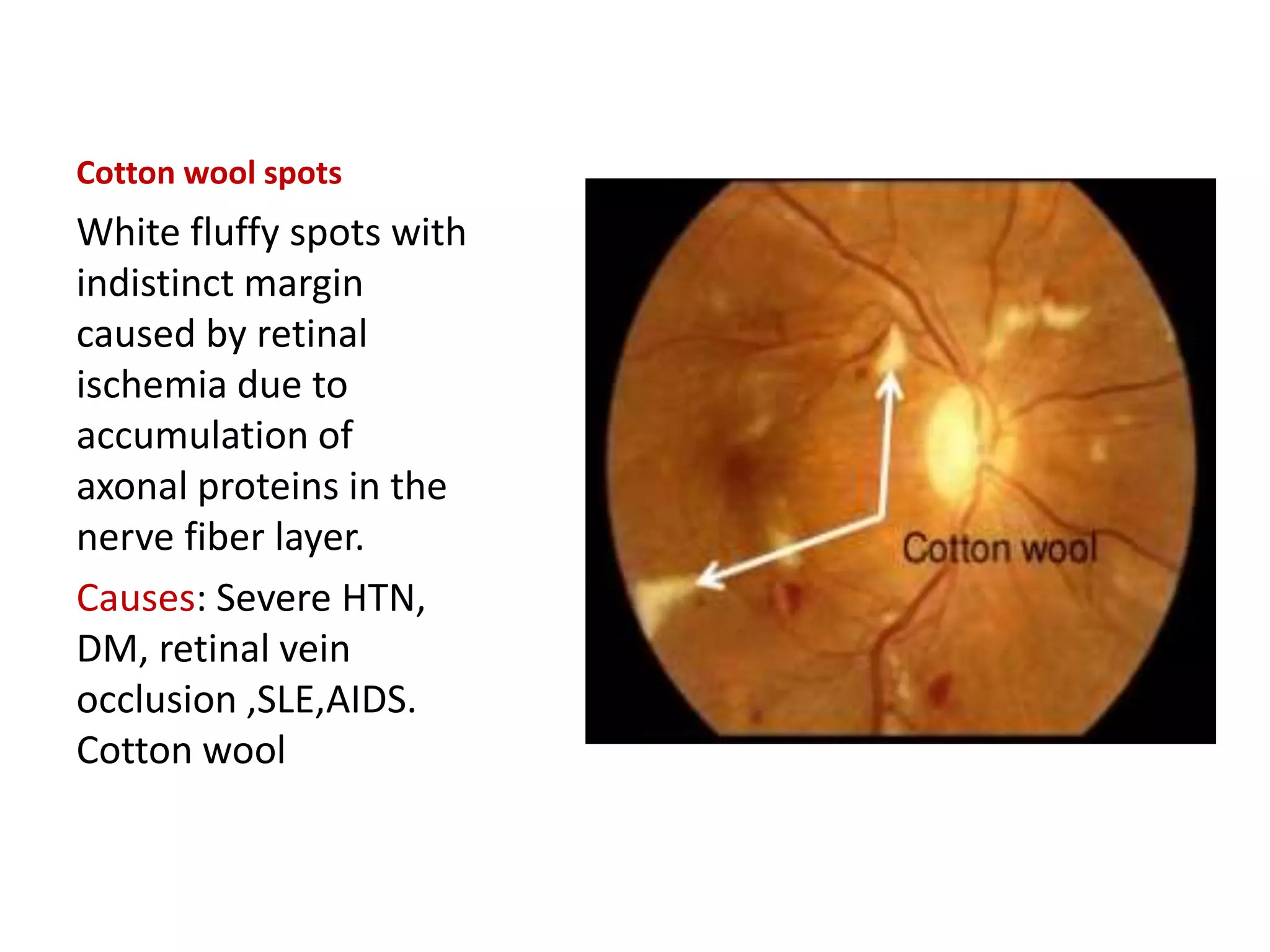 Fundus examination | PPTX