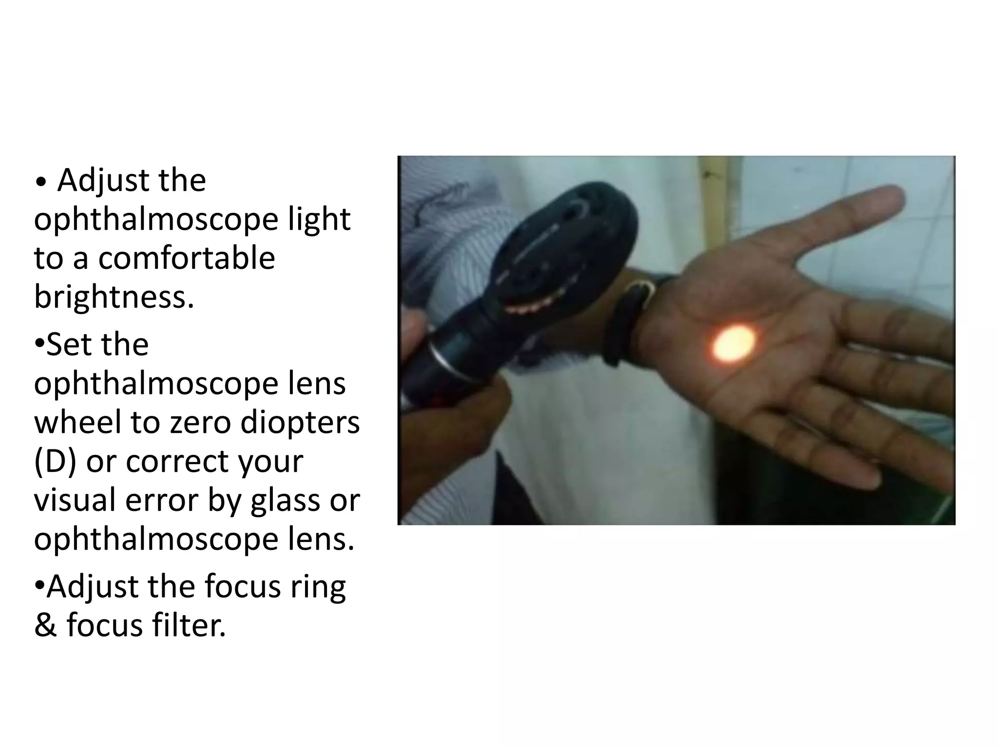 Fundus examination | PPTX