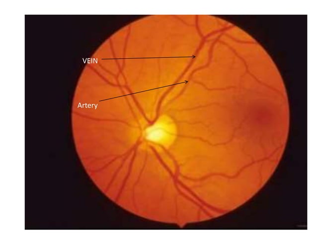 Fundus examination | PPTX