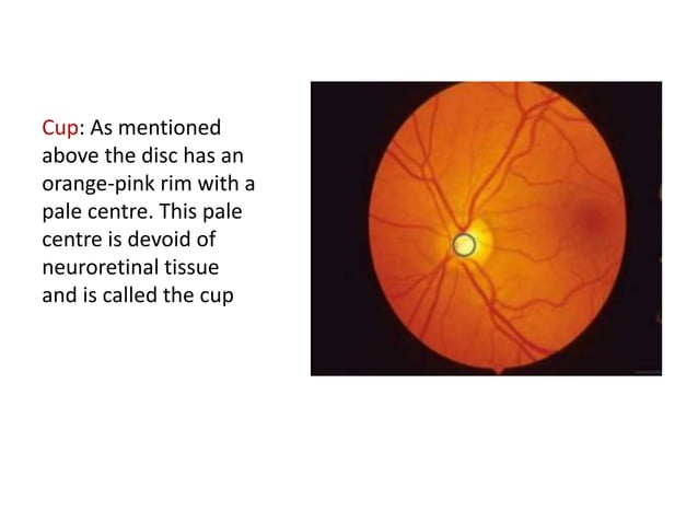 Fundus examination | PPTX