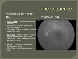 Fundus fluorescein angiography | PPTX