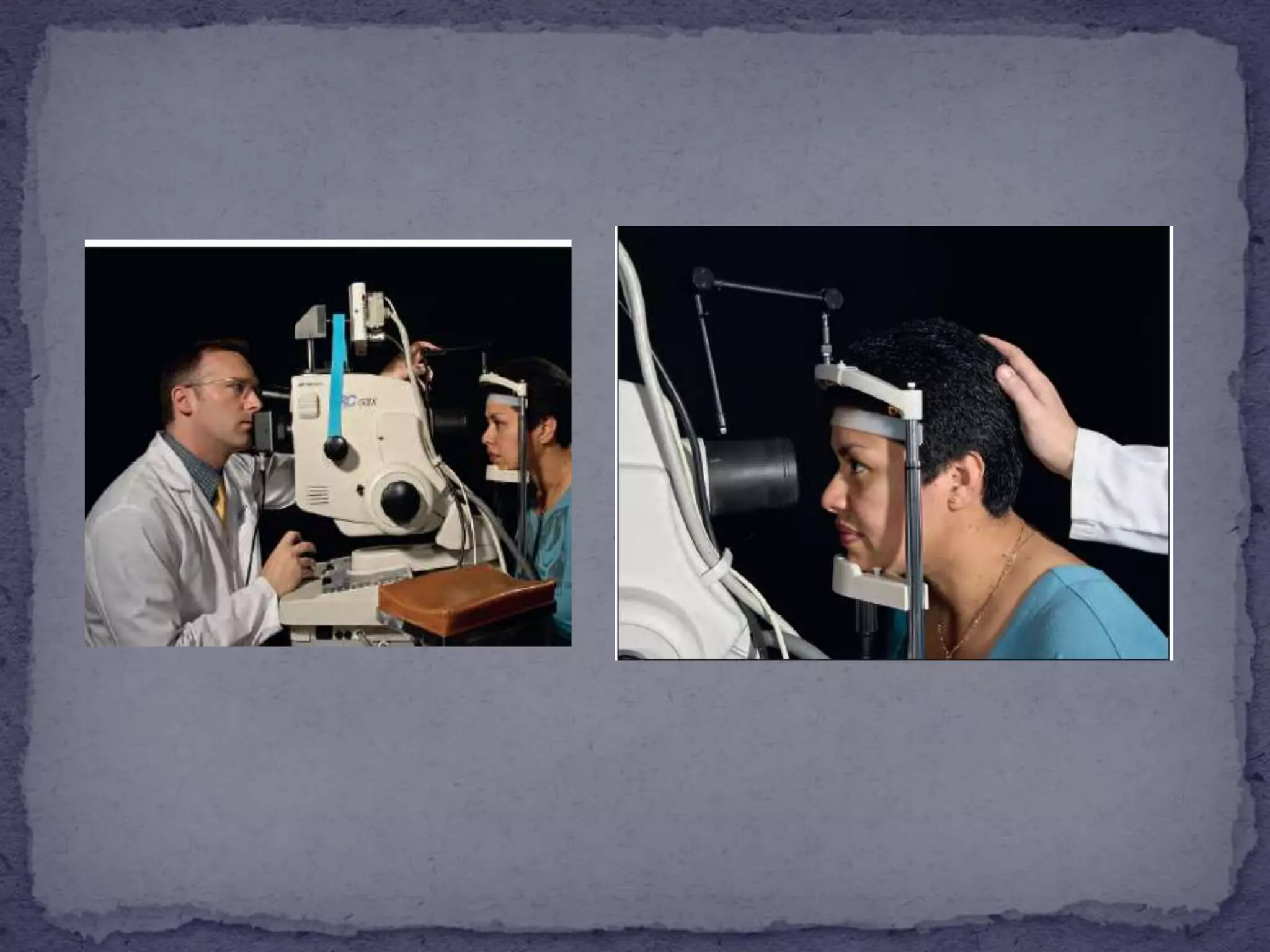 Fundus fluorescein angiography of retina | PPTX