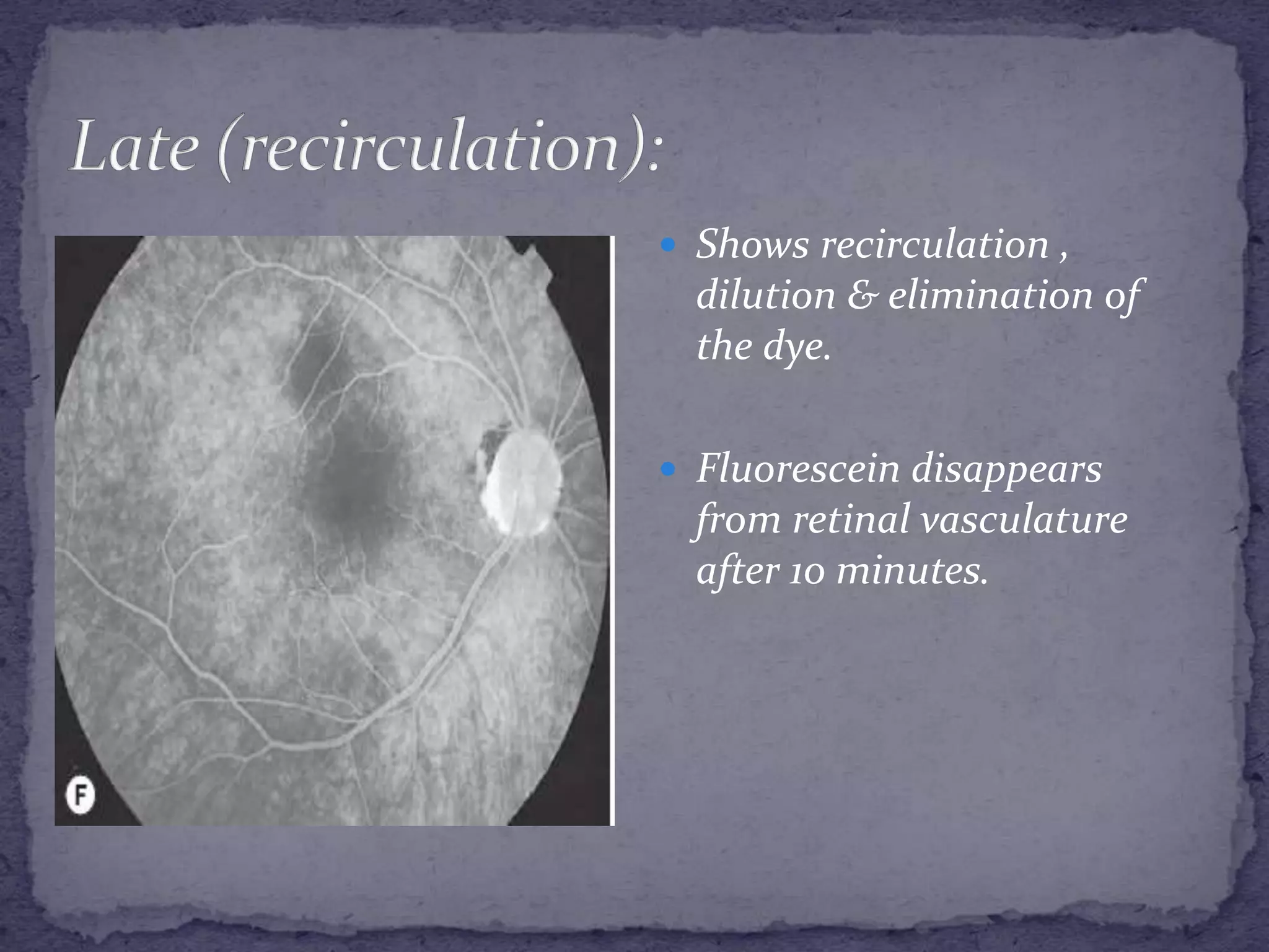 Fundus fluorescein angiography of retina | PPTX