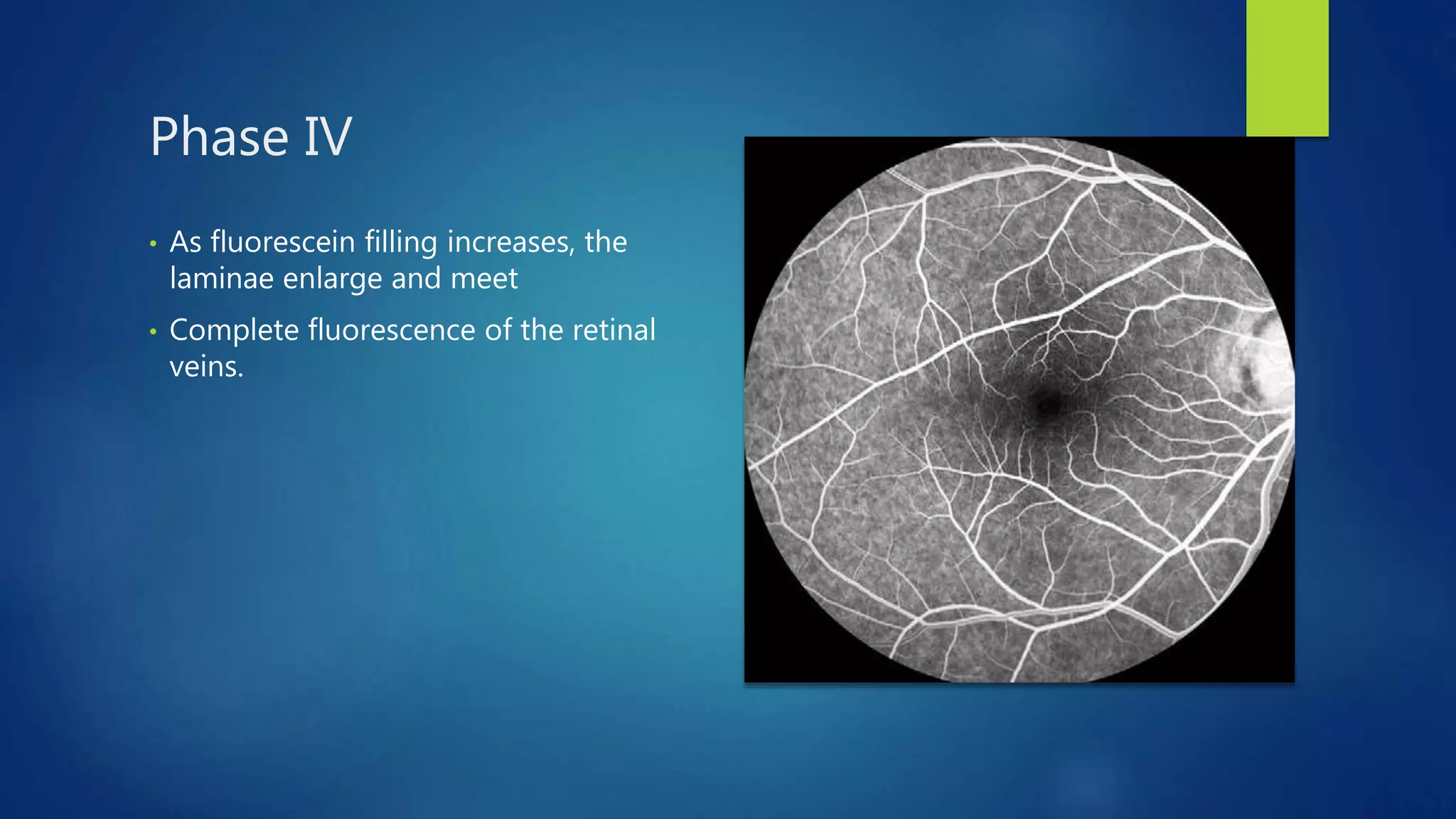Fundus fluorescein angiography | PPTX | Eye and Vision Conditions ...