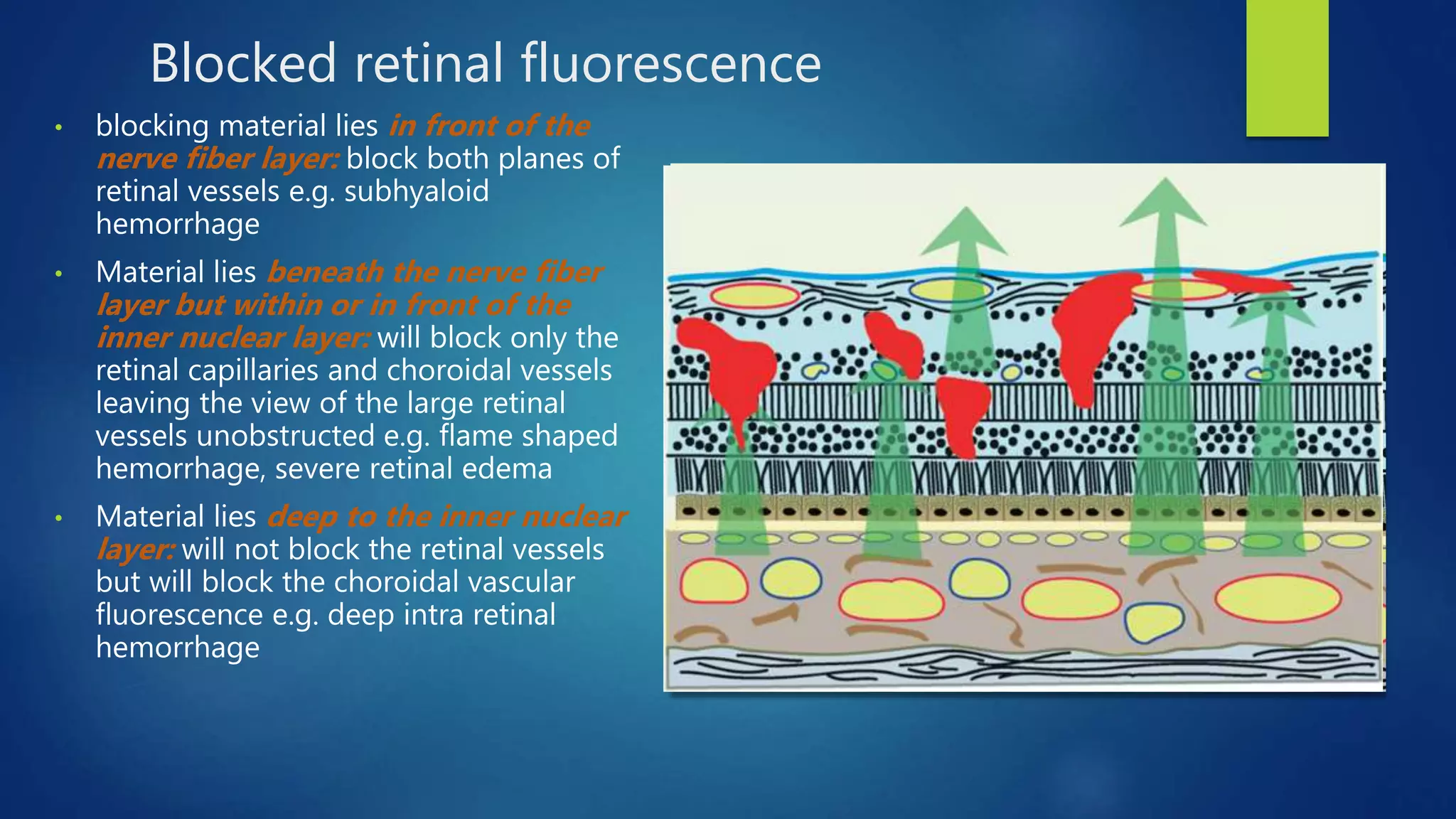 Fundus fluorescein angiography | PPTX