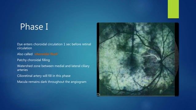 Fundus fluorescein angiography | PPTX | Eye and Vision Conditions ...