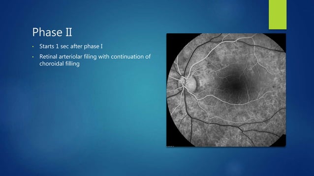 Fundus fluorescein angiography | PPTX | Eye and Vision Conditions ...
