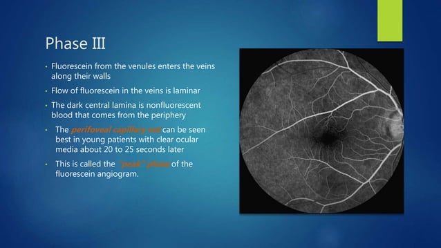 Fundus fluorescein angiography | PPTX | Eye and Vision Conditions ...