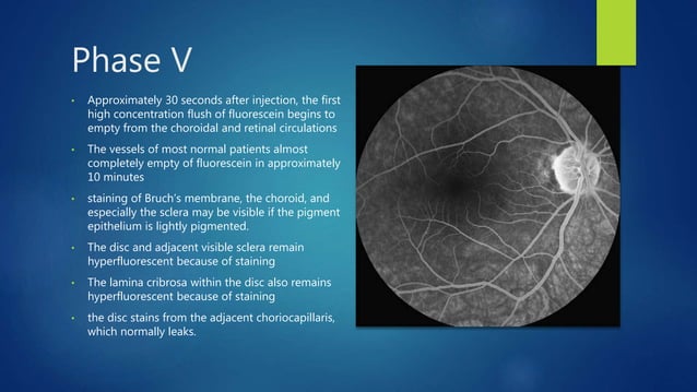 Fundus fluorescein angiography | PPTX | Eye and Vision Conditions ...