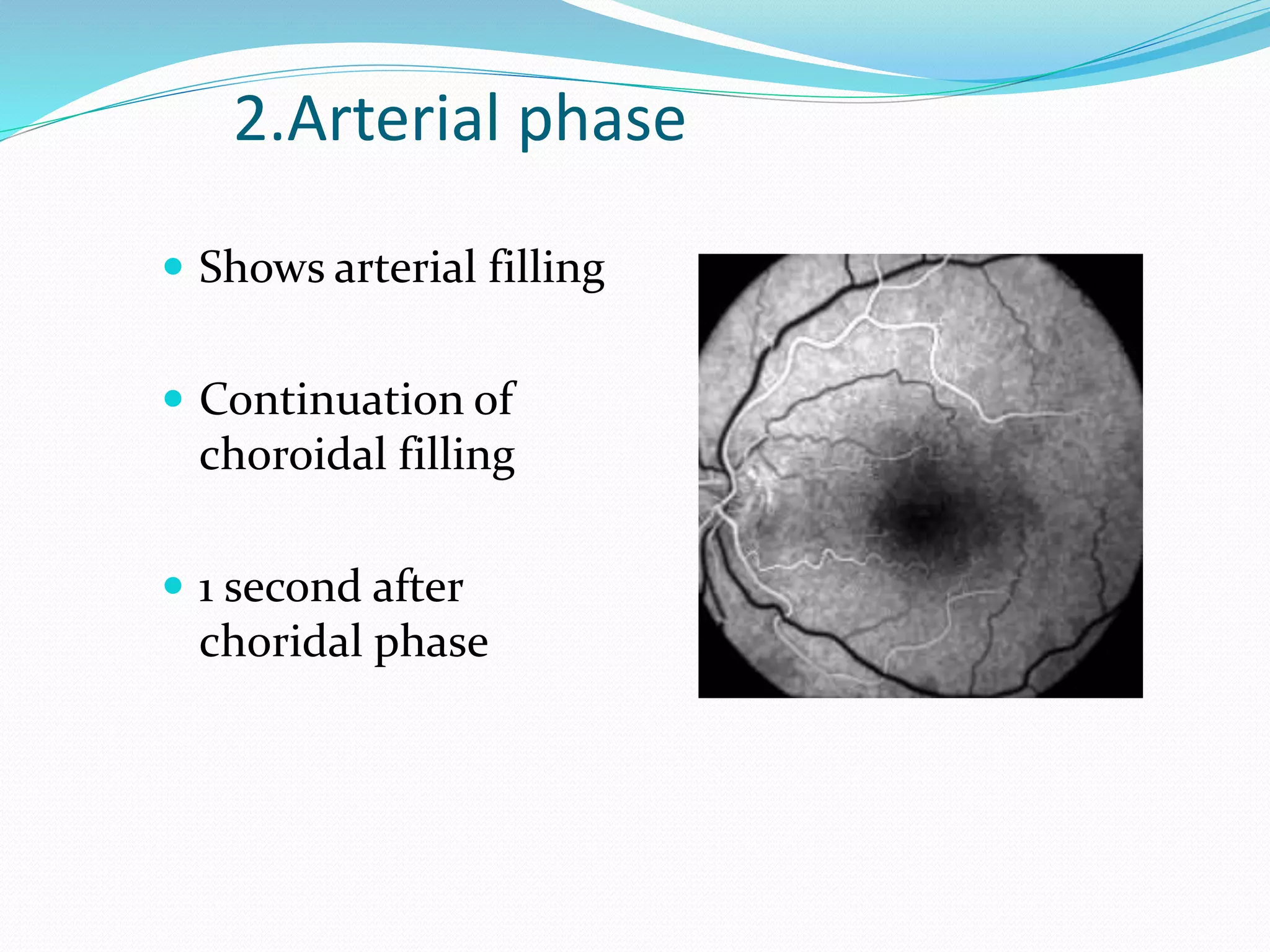Fundus fluorescein angiography and B-scan by vijay | PPTX