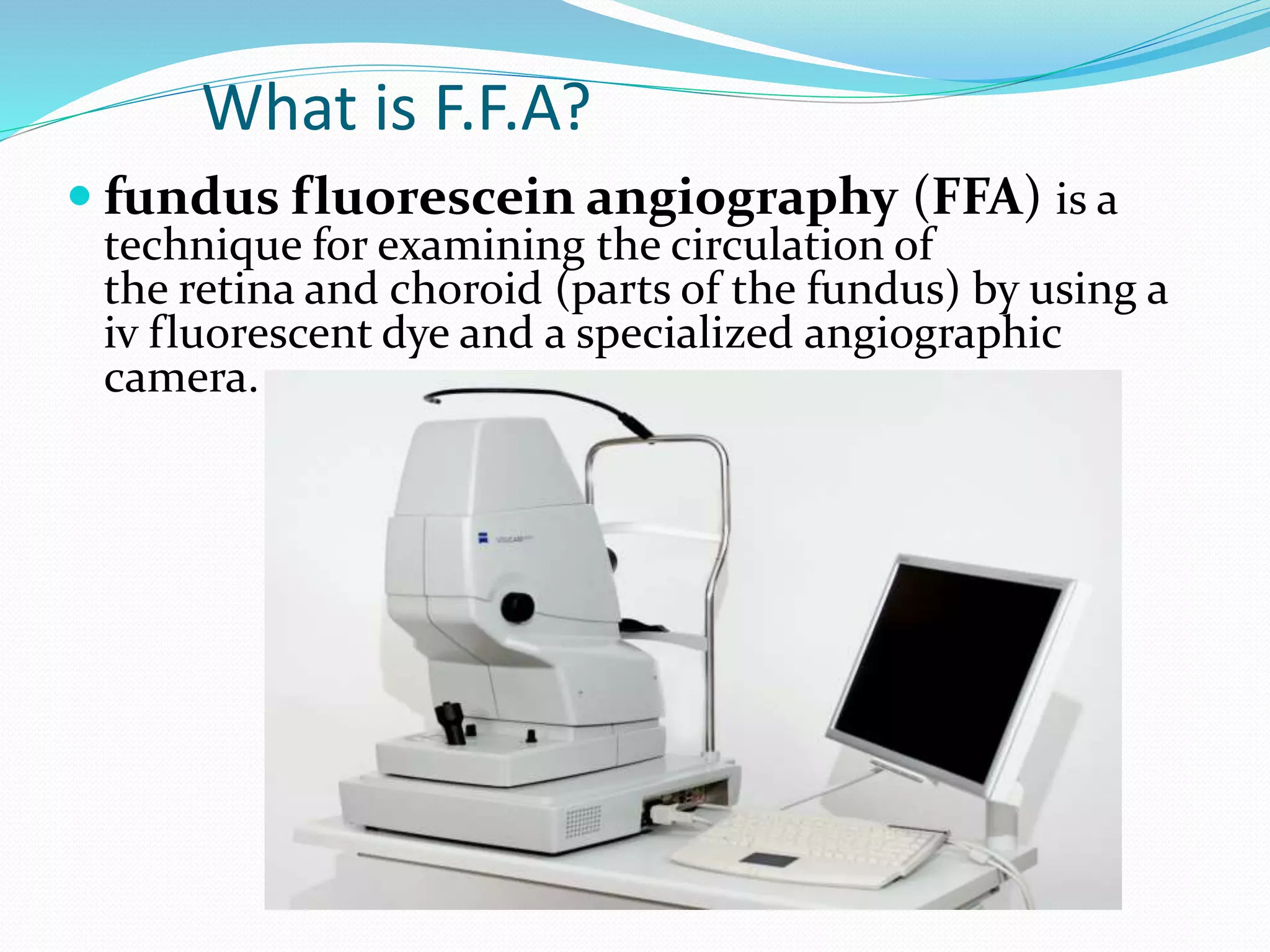 Fundus fluorescein angiography and B-scan by vijay | PPTX