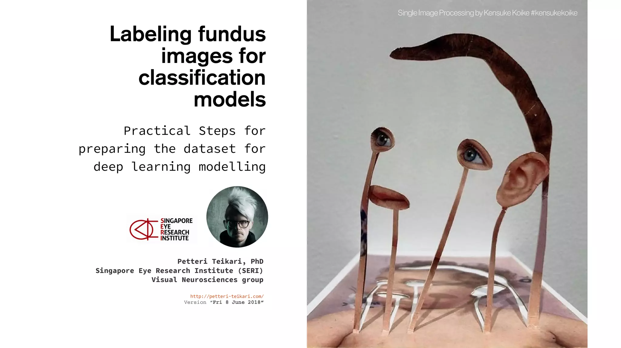 Labeling fundus images for classification models | PDF | Eye and Vision Conditions | Diseases ...