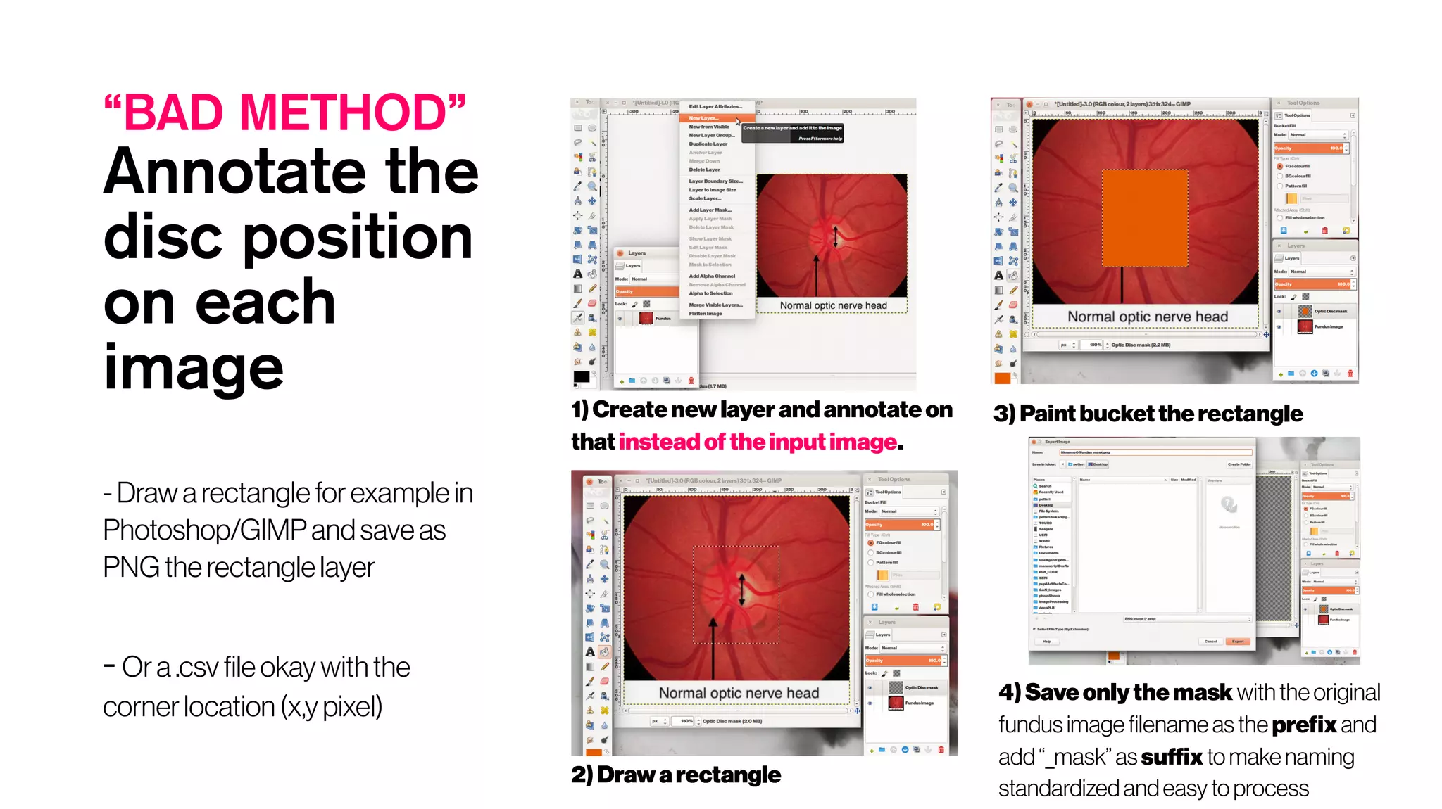 Labeling fundus images for classification models | PDF | Eye and Vision Conditions | Diseases ...