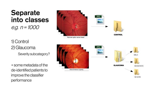 Labeling fundus images for classification models | PDF | Eye and Vision ...