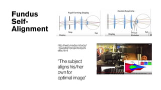 Optical Designs for Fundus Cameras | PDF