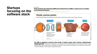 Optical Designs for Fundus Cameras | PDF