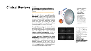 Optical Designs for Fundus Cameras | PDF