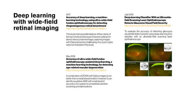 Optical Designs for Fundus Cameras | PDF | Eye and Vision Conditions ...