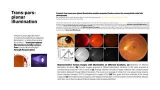Optical Designs for Fundus Cameras | PDF