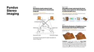 Optical Designs for Fundus Cameras | PDF