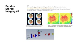 Optical Designs for Fundus Cameras | PDF