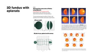 Optical Designs for Fundus Cameras | PDF