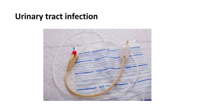 Fungal Infection diagnosis and management in ICU | PPT
