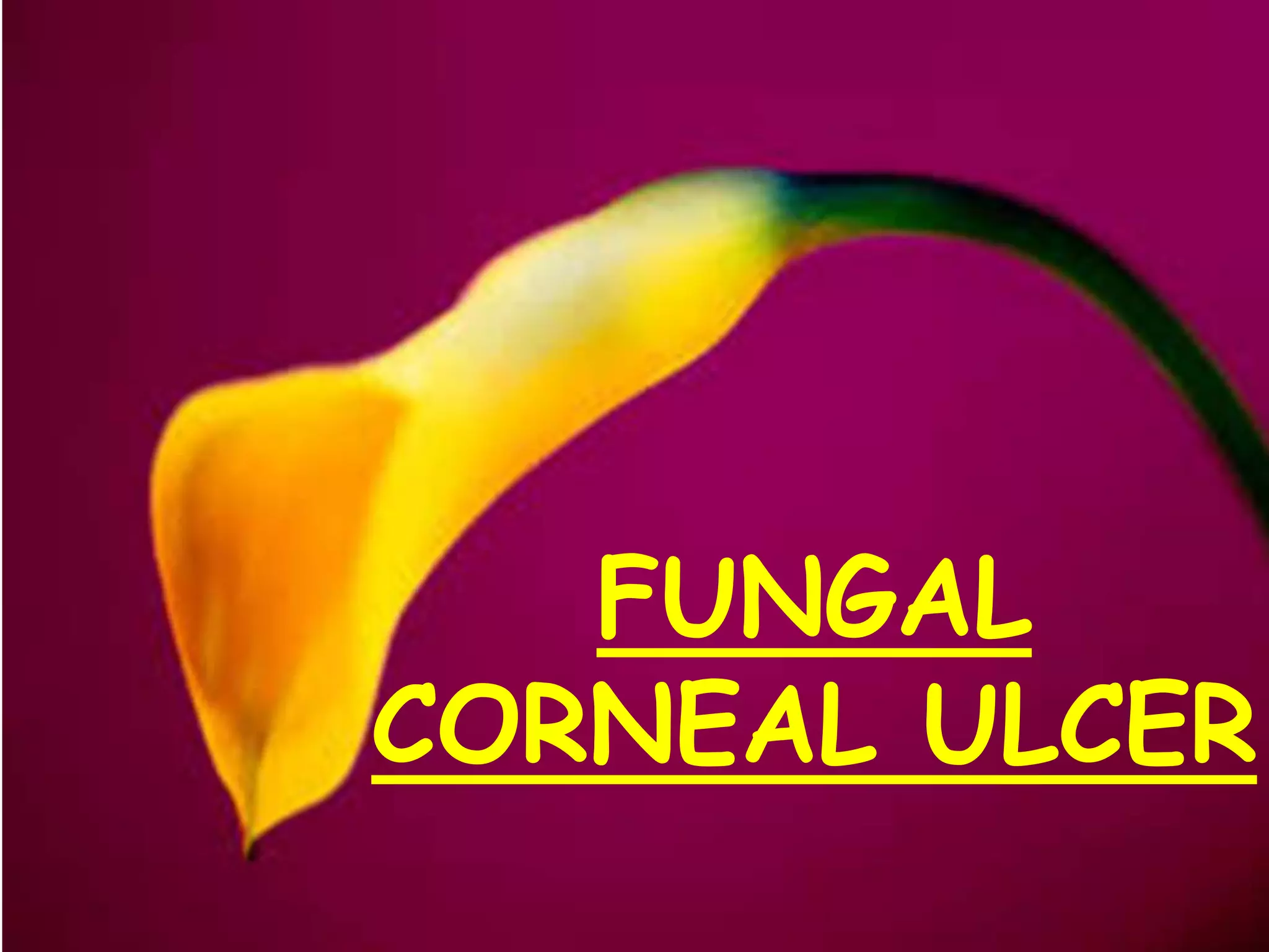 Fungal Corneal Ulcer Pptx