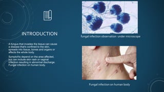 FUNGAL.pptx
