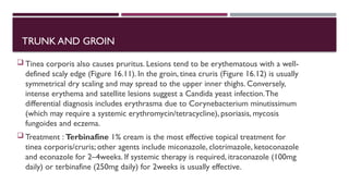 Fungal-Infections.pptx- fungal infections a lecture for students | PPTX