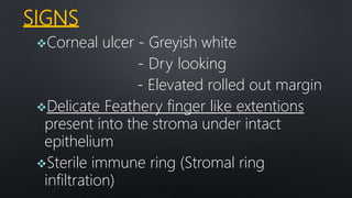 Fungal Corneal Ulcer Ophthalmology PPT.pptx