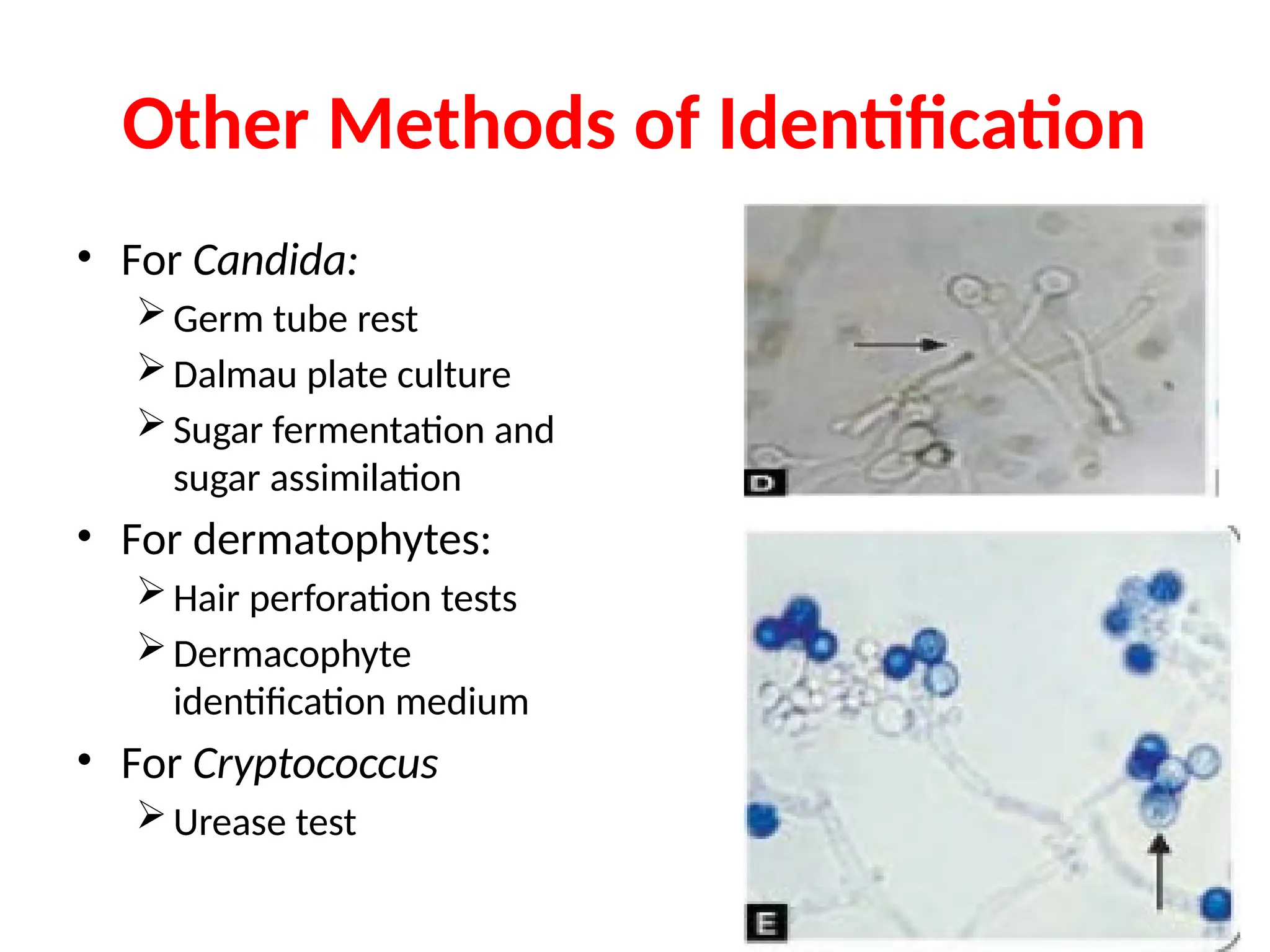 fungaldiagnosis-200728061058..............pptx
